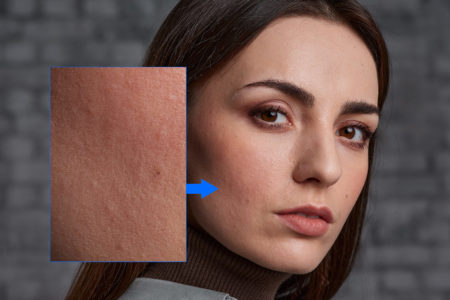 Get 20% OFF Retouch4me AI-Powered Skin Retouching