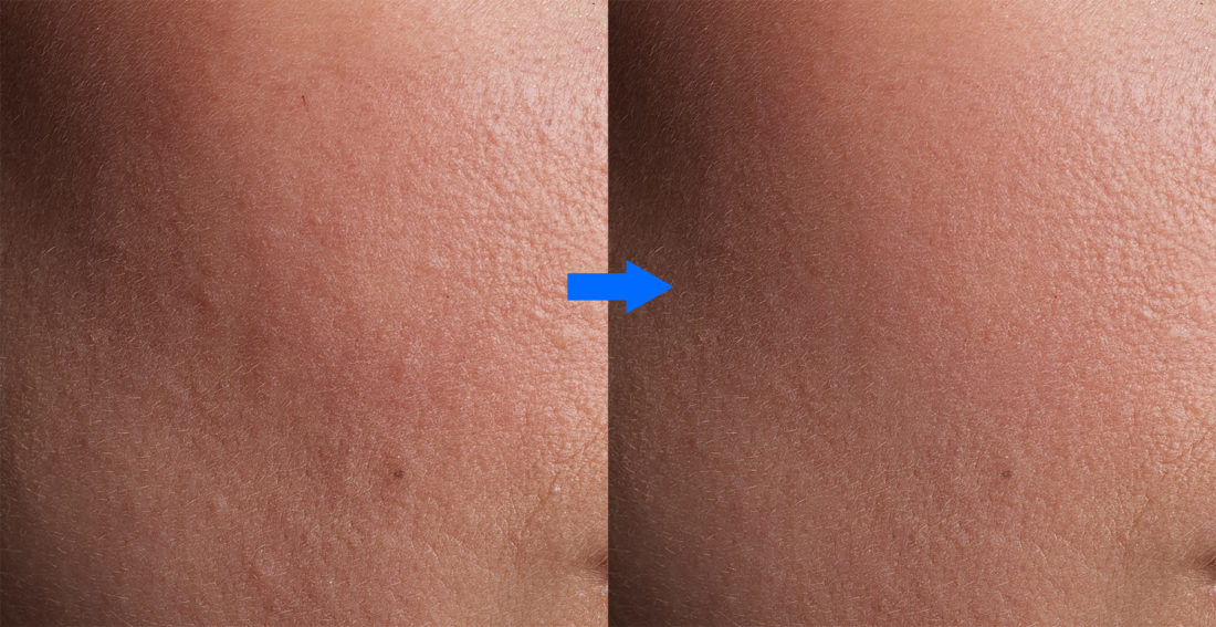 Get 20% OFF Retouch4me AI-Powered Skin Retouching