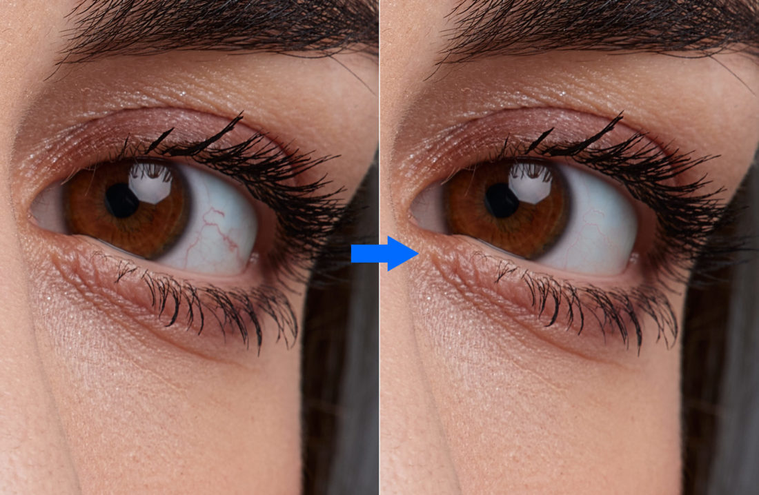 Get 20% OFF Retouch4me AI-Powered Skin Retouching